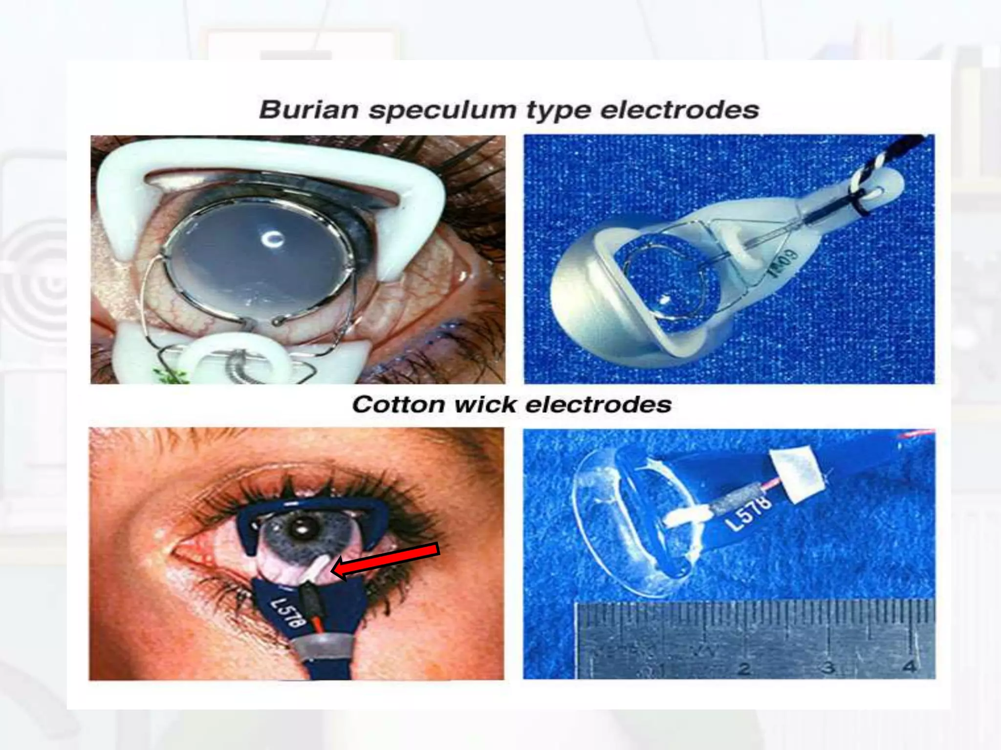 Electrophysiology of the Eye | PPTX