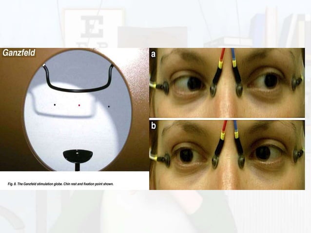 Electrophysiology of the Eye | PPTX | Eye and Vision Conditions ...