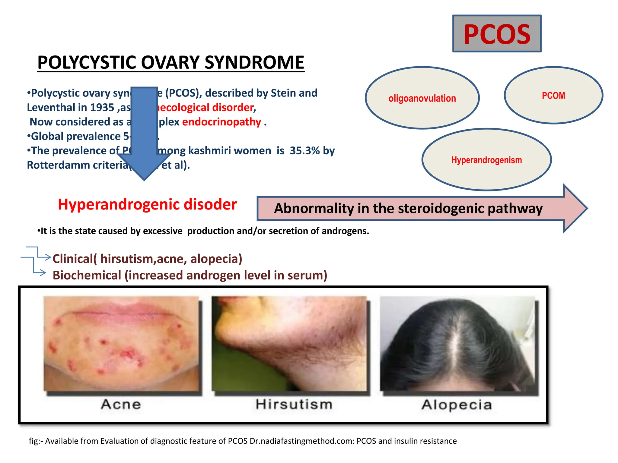 PCOS | PPTX