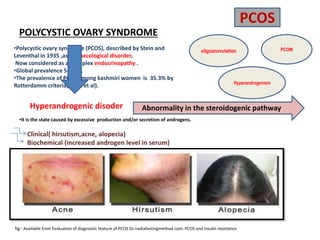 PCOS | PPTX
