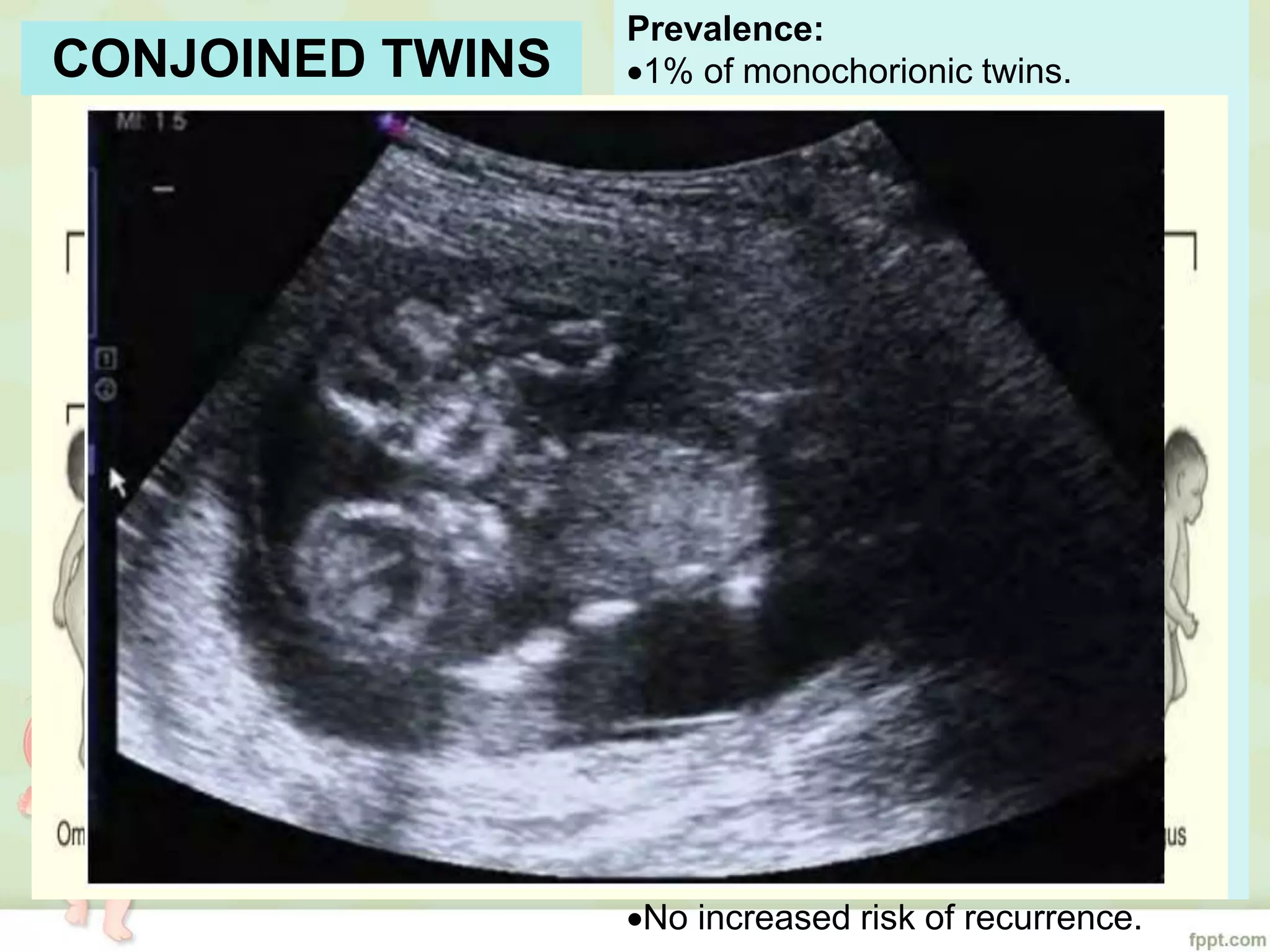 ROLE OF ULTRASOUND IN MULTIFETAL GESTATION - WHAT AN OBSTETRICIAN ...