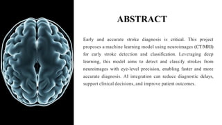 Innovation in Stroke Identification: A Machine Learning-Based ...
