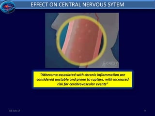 Awareness regarding the systemic effects- PERIO SYSTEMIC RELATIONSHIP ...