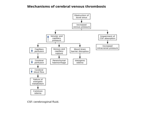 CVST central venous sinus thrombosis.pptx | Ear, Nose and Throat ...