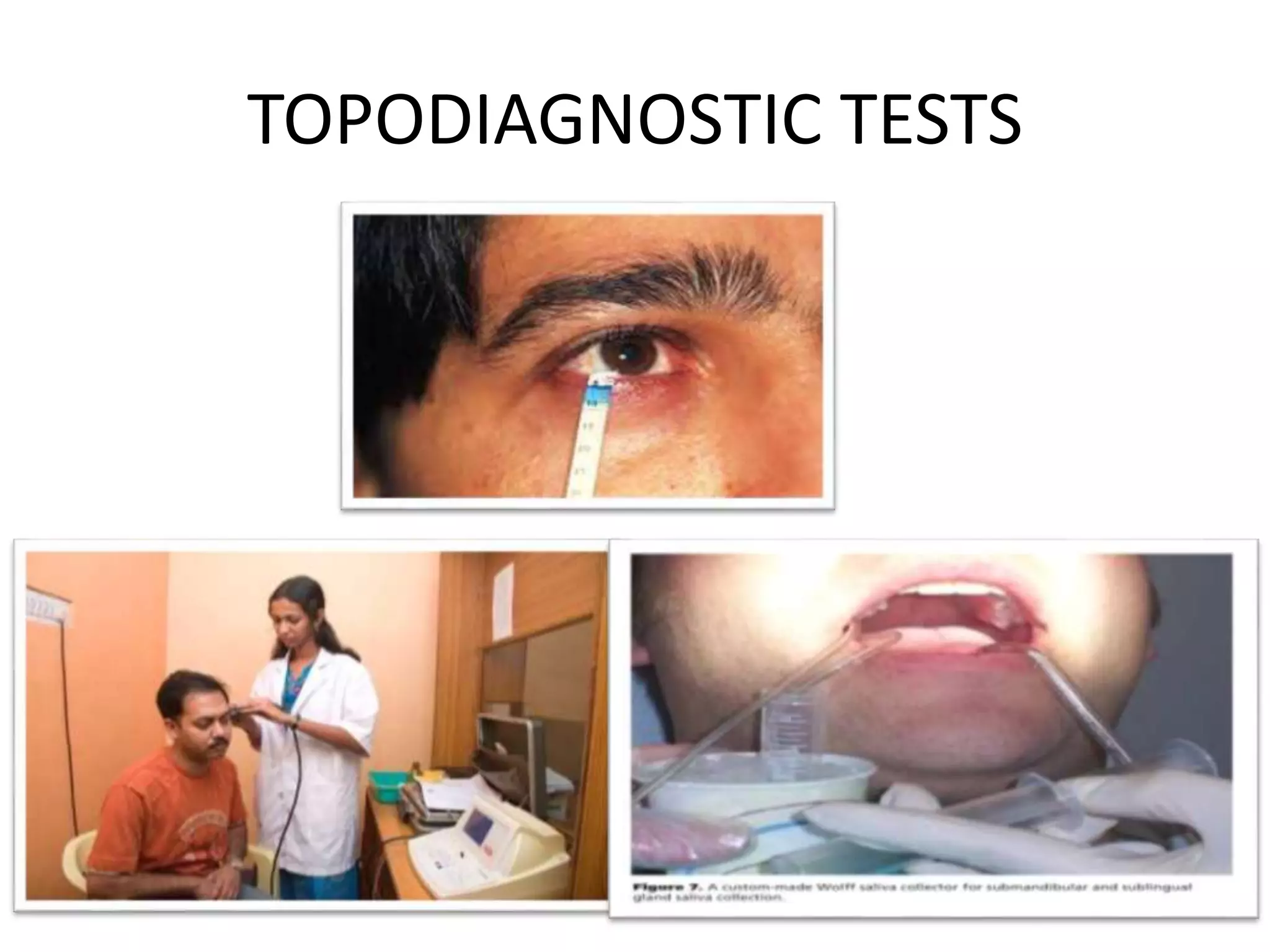 facial nerve- pathophysiology, electrodiagnostic and imaging | PPTX