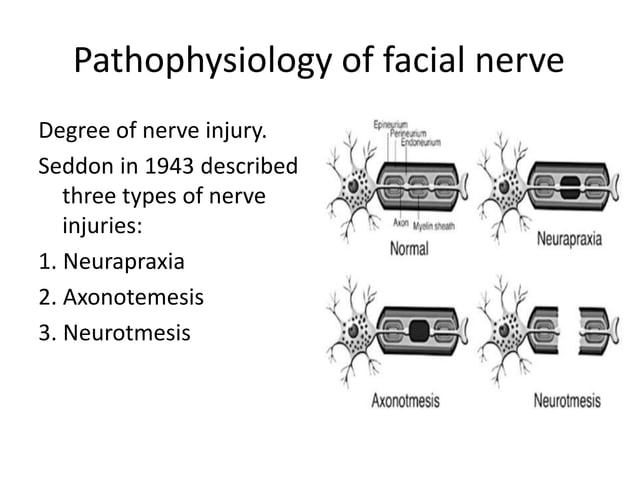 facial nerve- pathophysiology, electrodiagnostic and imaging | PPTX ...