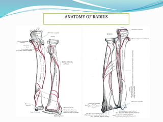 final ppt for synopsis fracture distal end radius k wiring pinning | PPTX