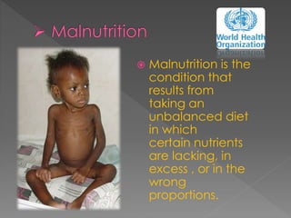Malnutrition | PPTX