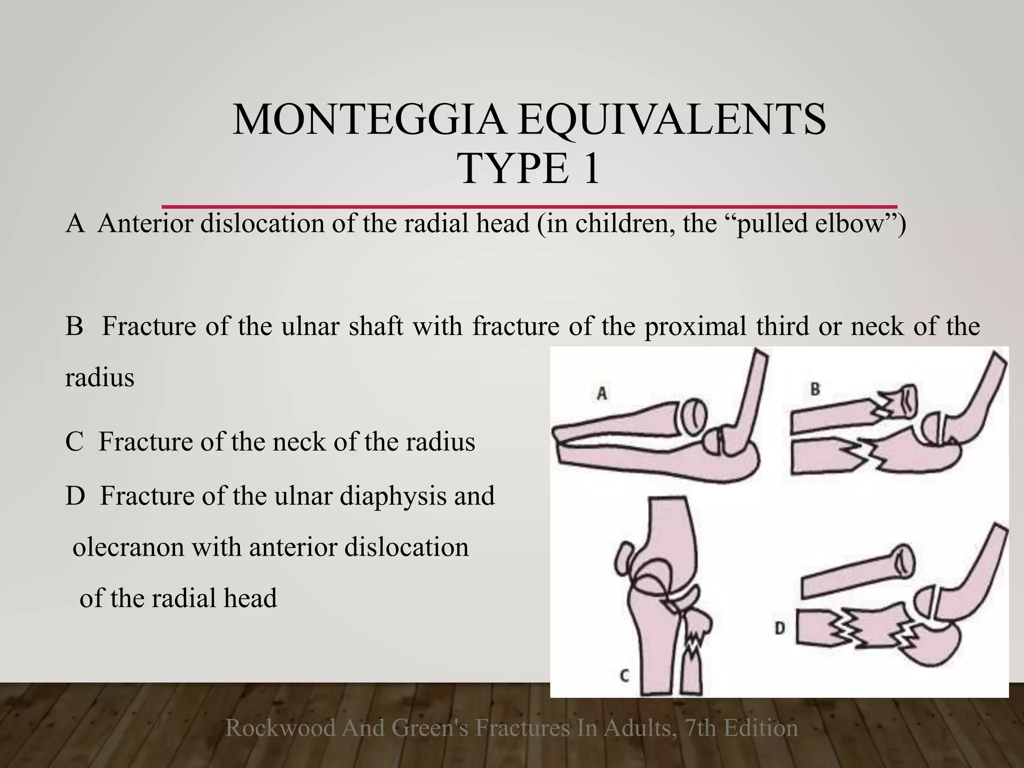 Monteggia fracture dislocation | PPTX