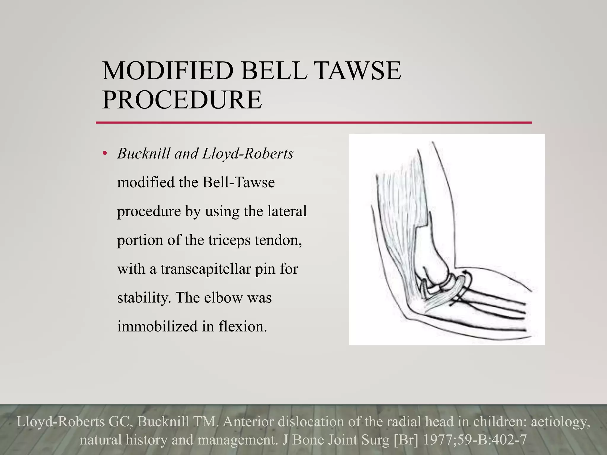 Monteggia fracture dislocation | PPTX