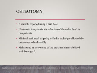 Monteggia fracture dislocation | PPTX