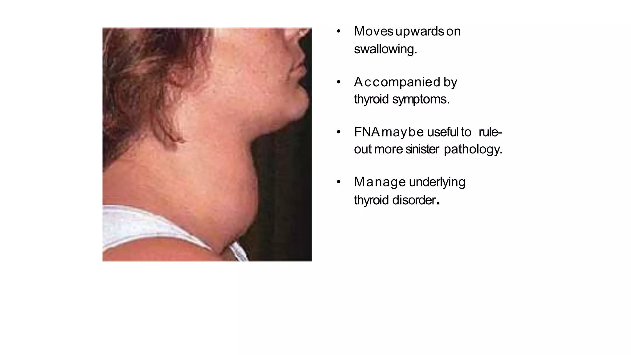 Final ppt neck swelling.pptx