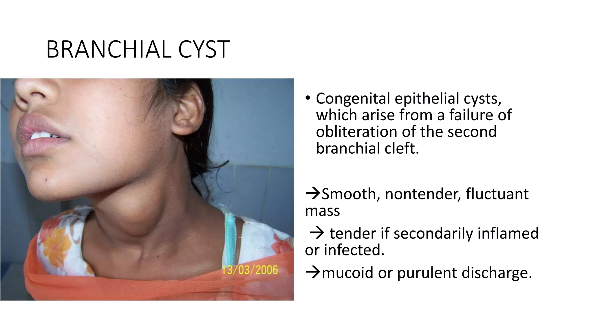 Final ppt neck swelling.pptx
