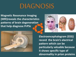 PRIONS THE CLINICAL CURIOSITY | PPTX