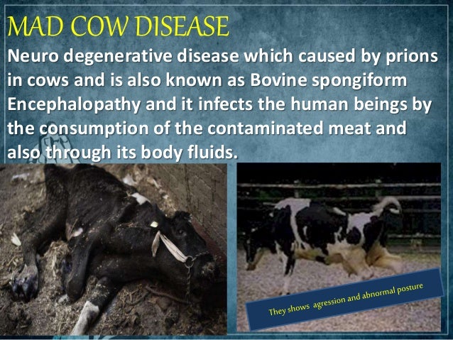 PRIONS THE CLINICAL CURIOSITY