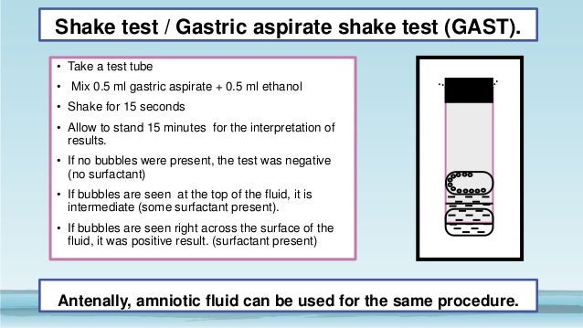 Respiratory physiology & Respiratory Distress syndrome in a newborn.