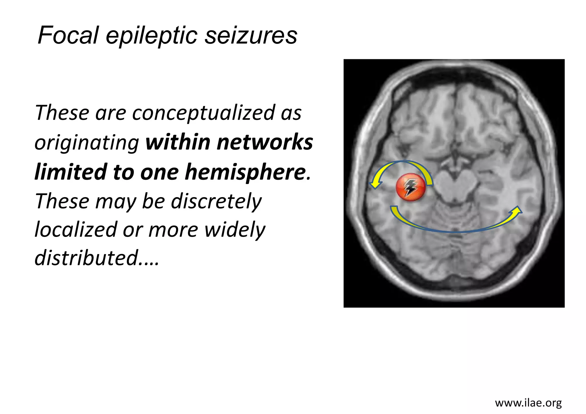semiological classification of seizure, localisation and lateralisation ...