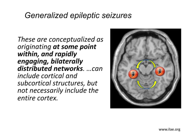 semiological classification of seizure, localisation and lateralisation ...