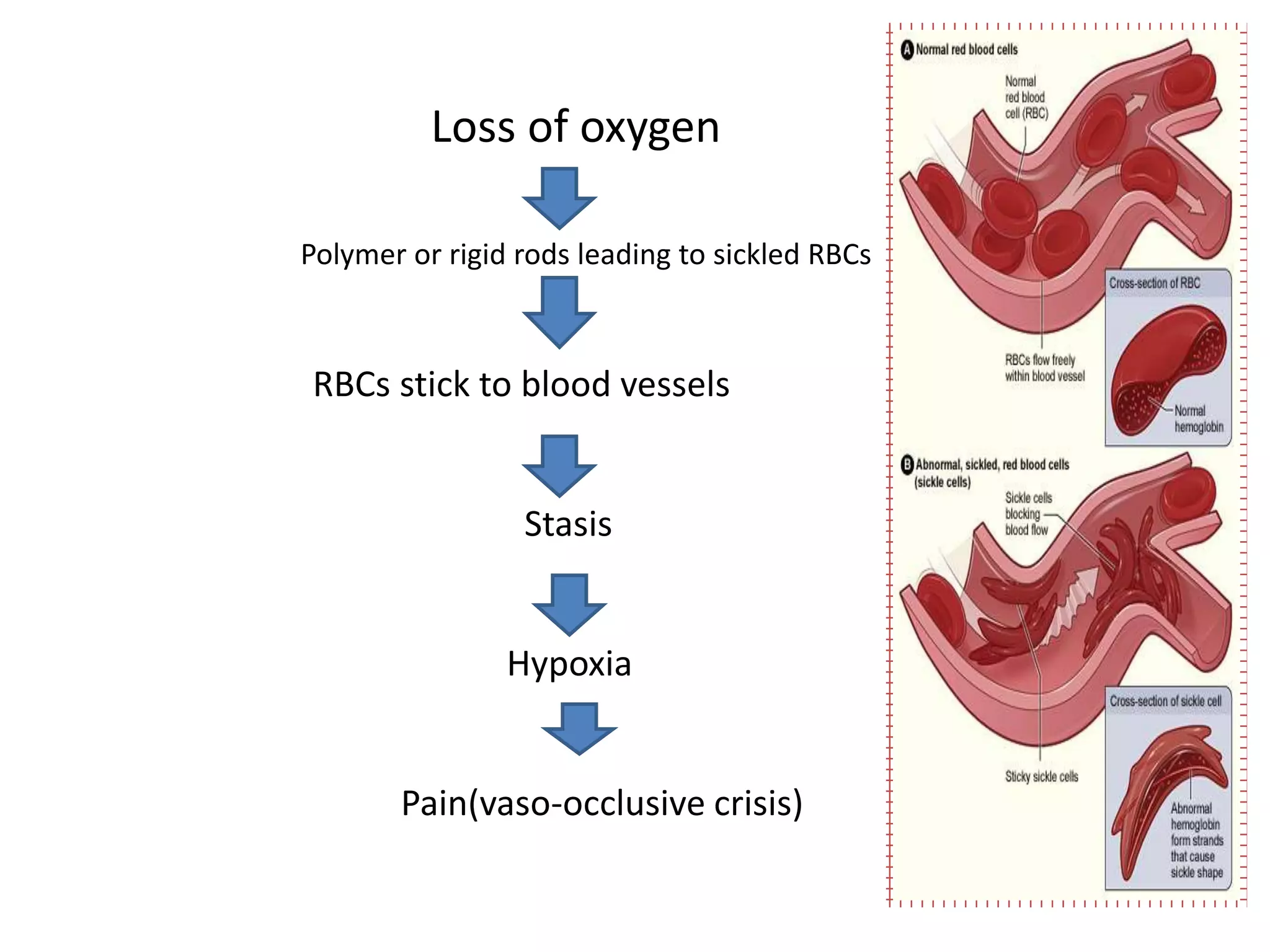 Final ppt sickle cell | PPTX