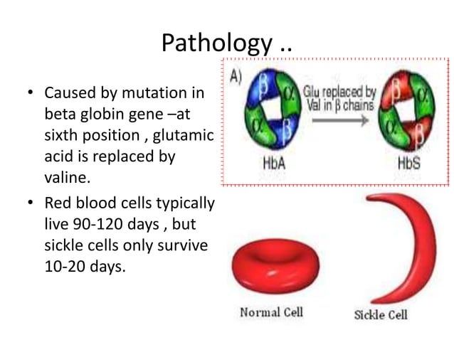 Final ppt sickle cell | PPTX | Blood Disorders | Diseases and Conditions