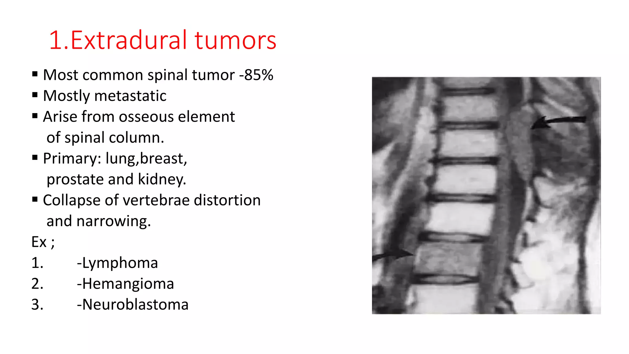 Spinal cord disorders.pptx