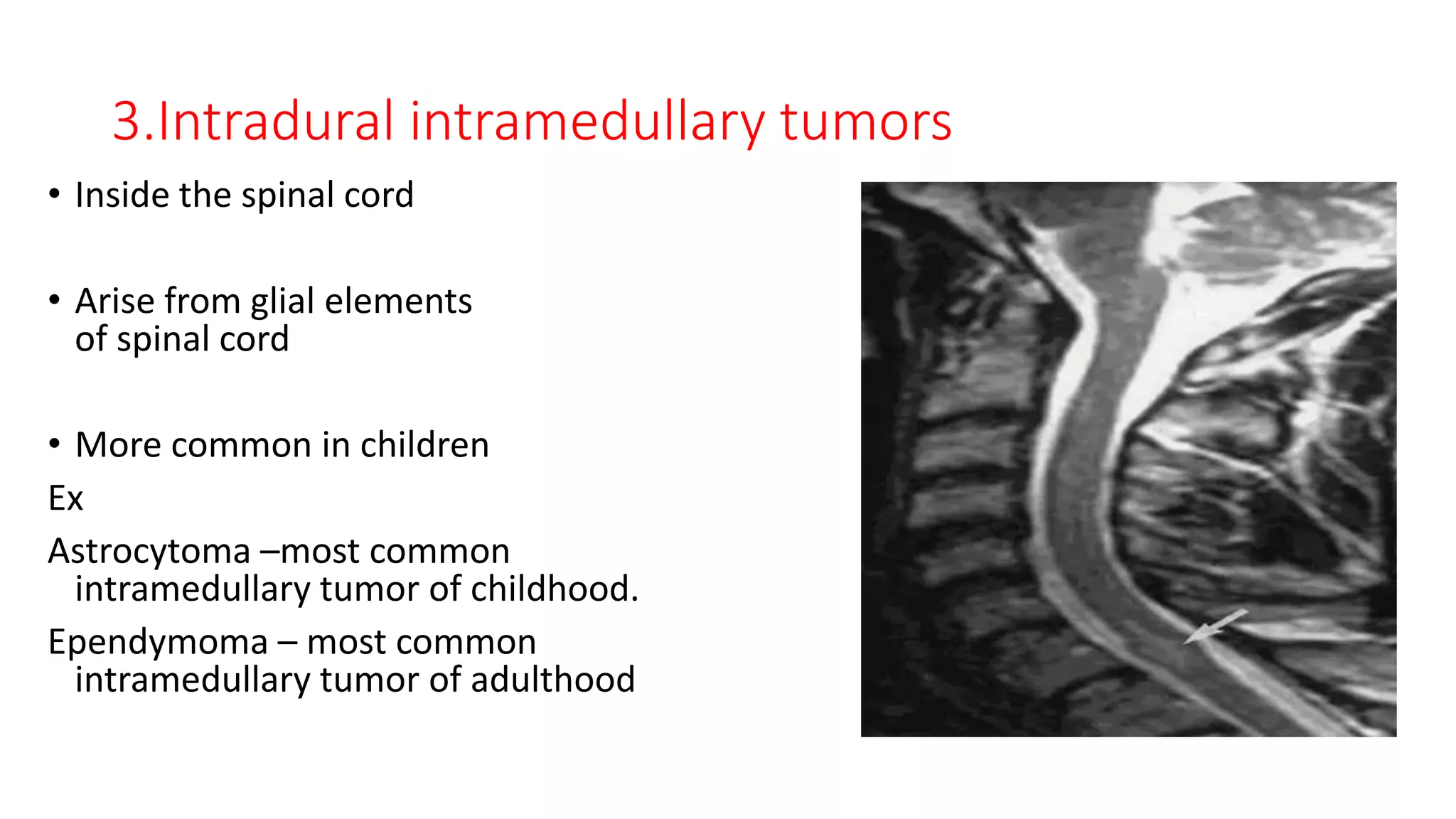 Spinal cord disorders.pptx