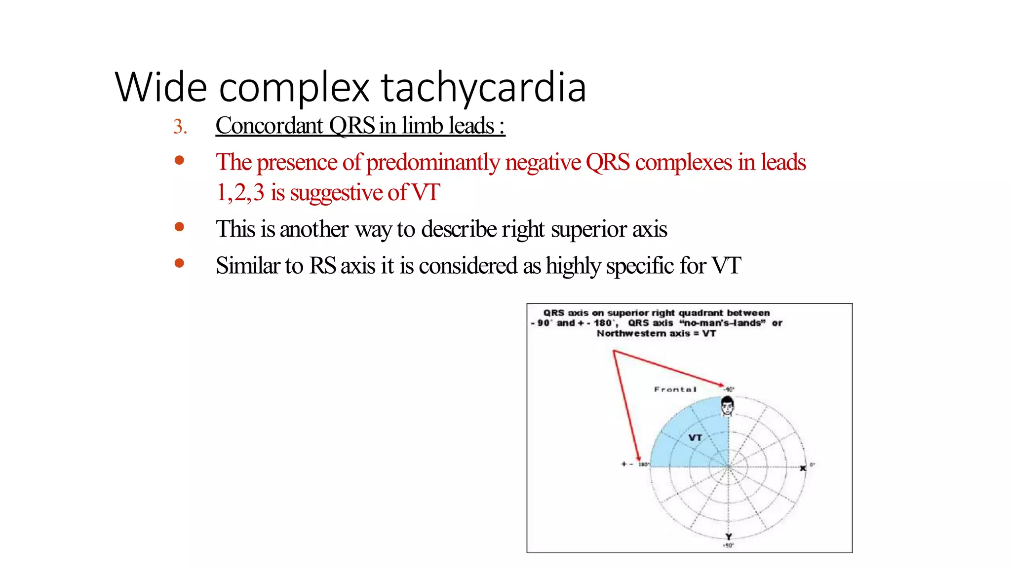 wide complex tachycardia.pptx