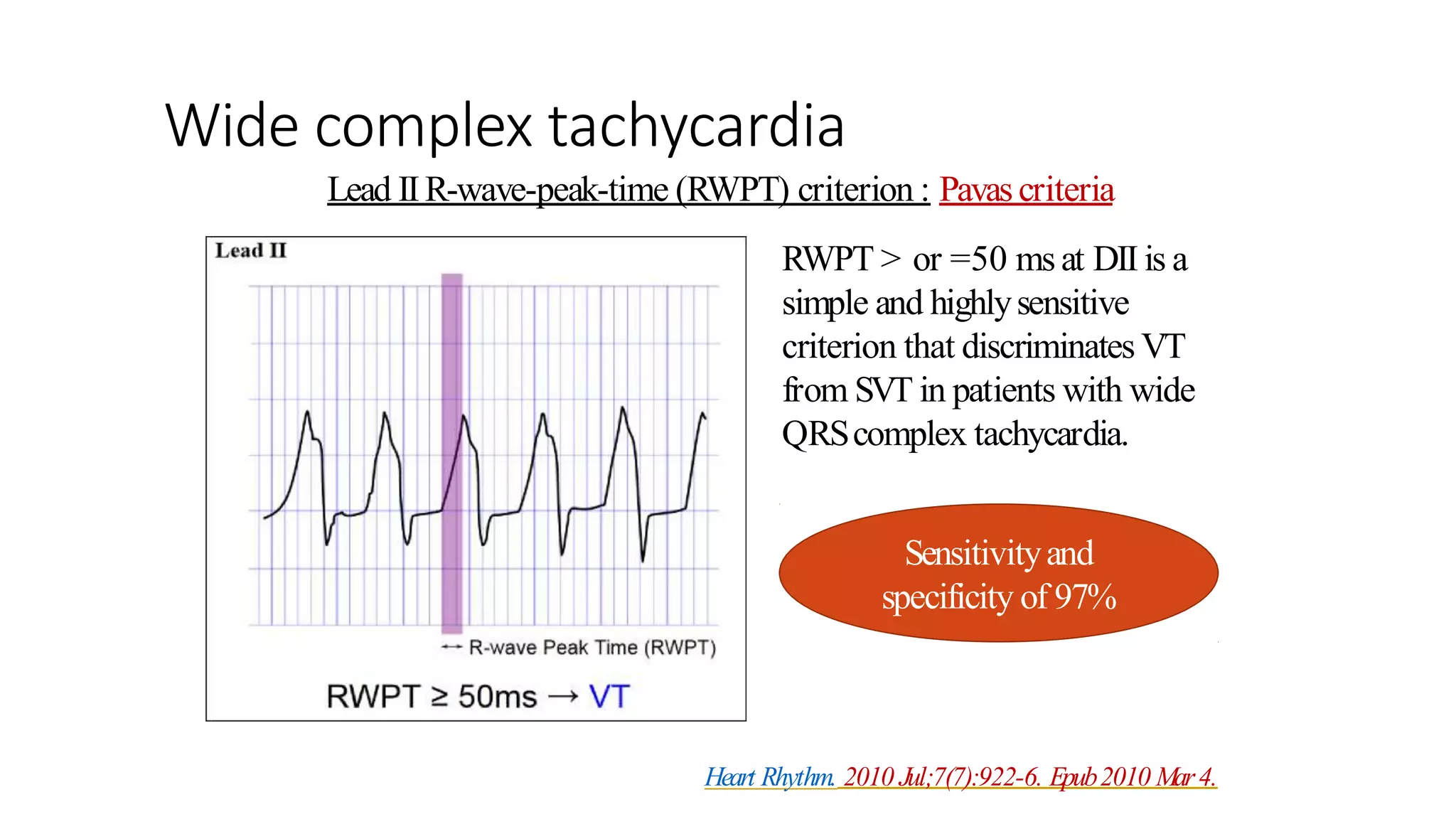 wide complex tachycardia.pptx