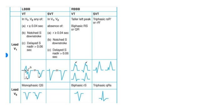 wide complex tachycardia.pptx