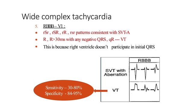 wide complex tachycardia.pptx