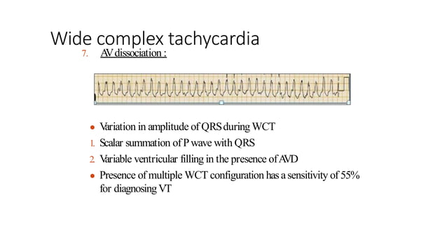 wide complex tachycardia.pptx