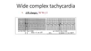 wide complex tachycardia.pptx