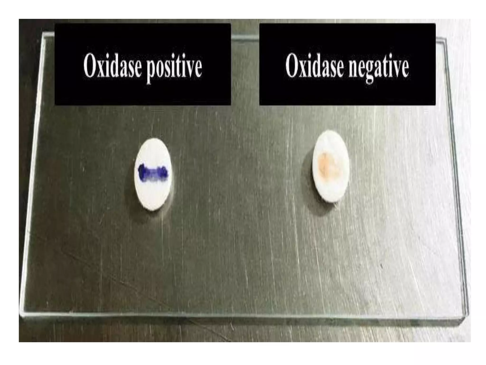 OXIDASE, CATALASE, COAGULASE TESTS.pptx | Chemistry | Science