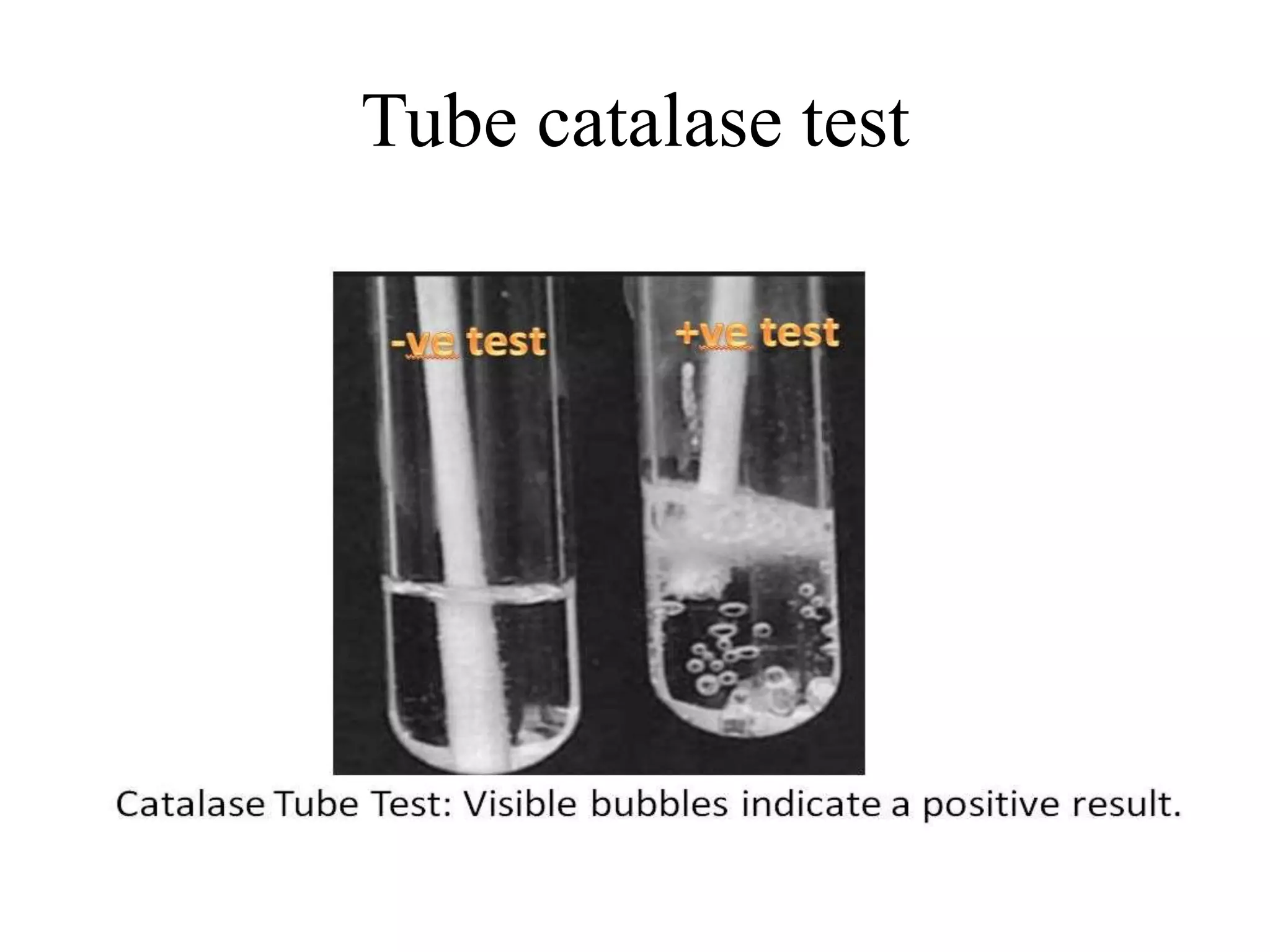 OXIDASE, CATALASE, COAGULASE TESTS.pptx