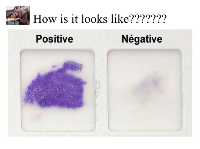 OXIDASE, CATALASE, COAGULASE TESTS.pptx | Chemistry | Science