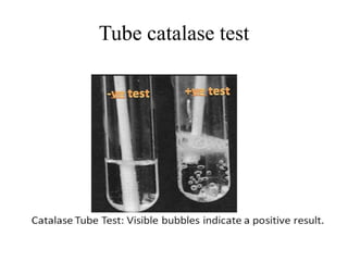 Catalase Test Tube