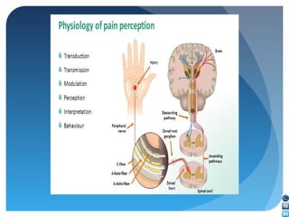 Pain management | PPT
