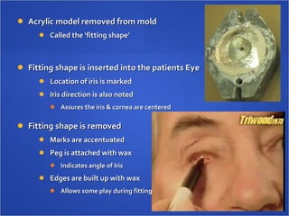 Making of an Eye | PPT