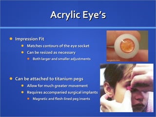 Making of an Eye | PPT