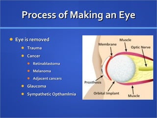 Making of an Eye | PPT