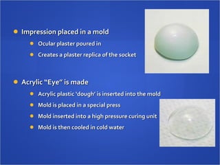 Making of an Eye | PPT