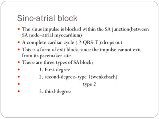 ECG: Type II Second degree SA Block | PPT