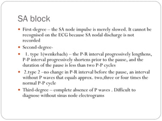 ECG: Type II Second degree SA Block | PPT