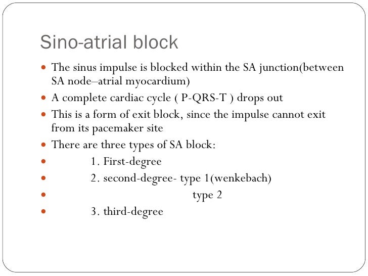 ECG: Type II Second degree SA Block