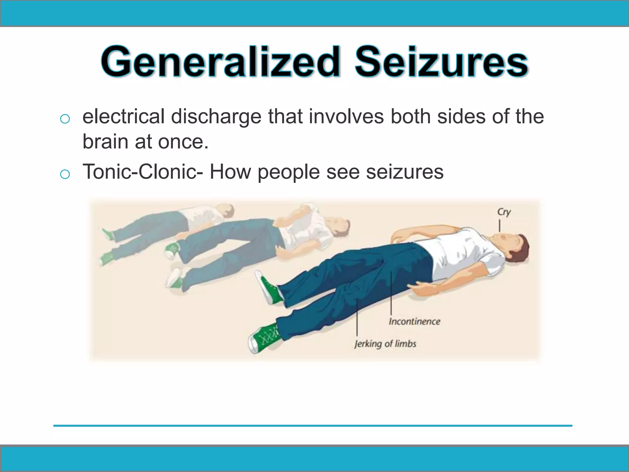 Seizures | PPTX