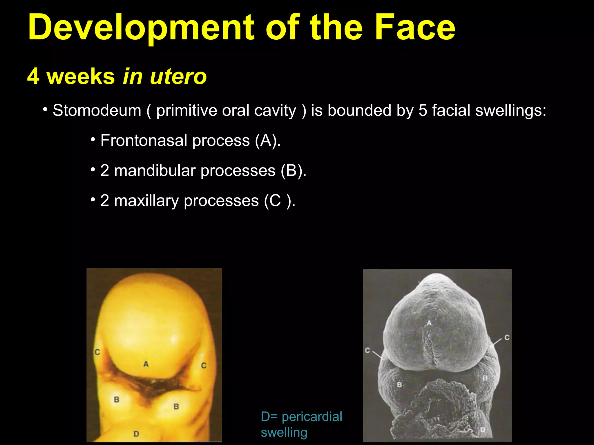 (Lec 3) Embryology - development of the maxillofacial complex | PPT