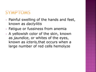 SICKLE CELL ANEMIA | PPT
