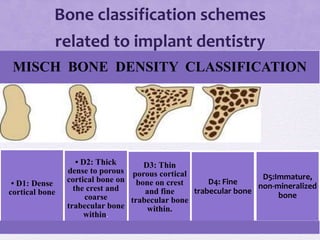 BONE | PPT