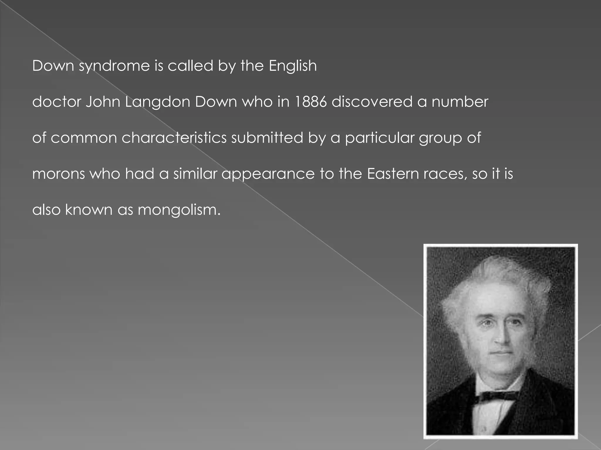 Down Syndrome Presentation | PPTX