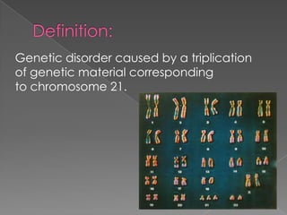 Down Syndrome Presentation | PPTX